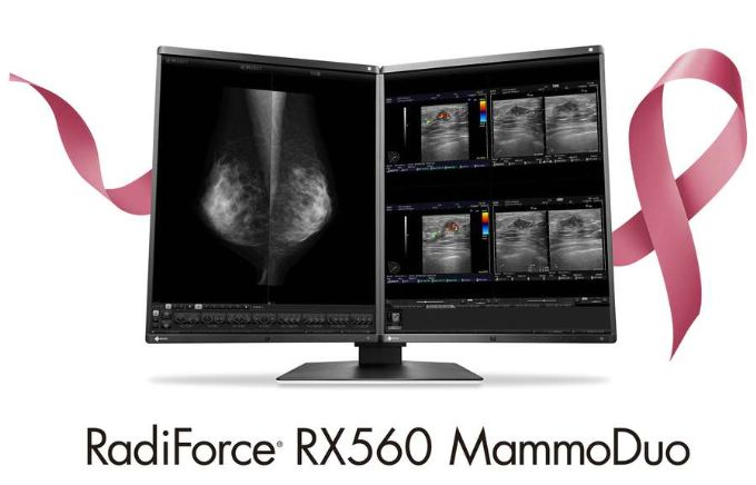EIZO推出500萬畫素彩色醫療顯示器RadiForce RX560 蘋果新聞-蘋果網